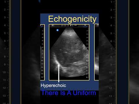 POCUS Essentials: Describing Echogenicity
