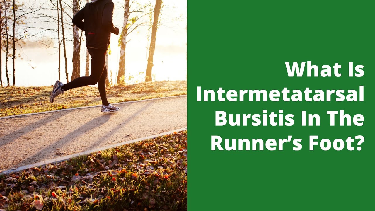 What Is Intermetatarsal Bursitis In The Runner’s Foot?