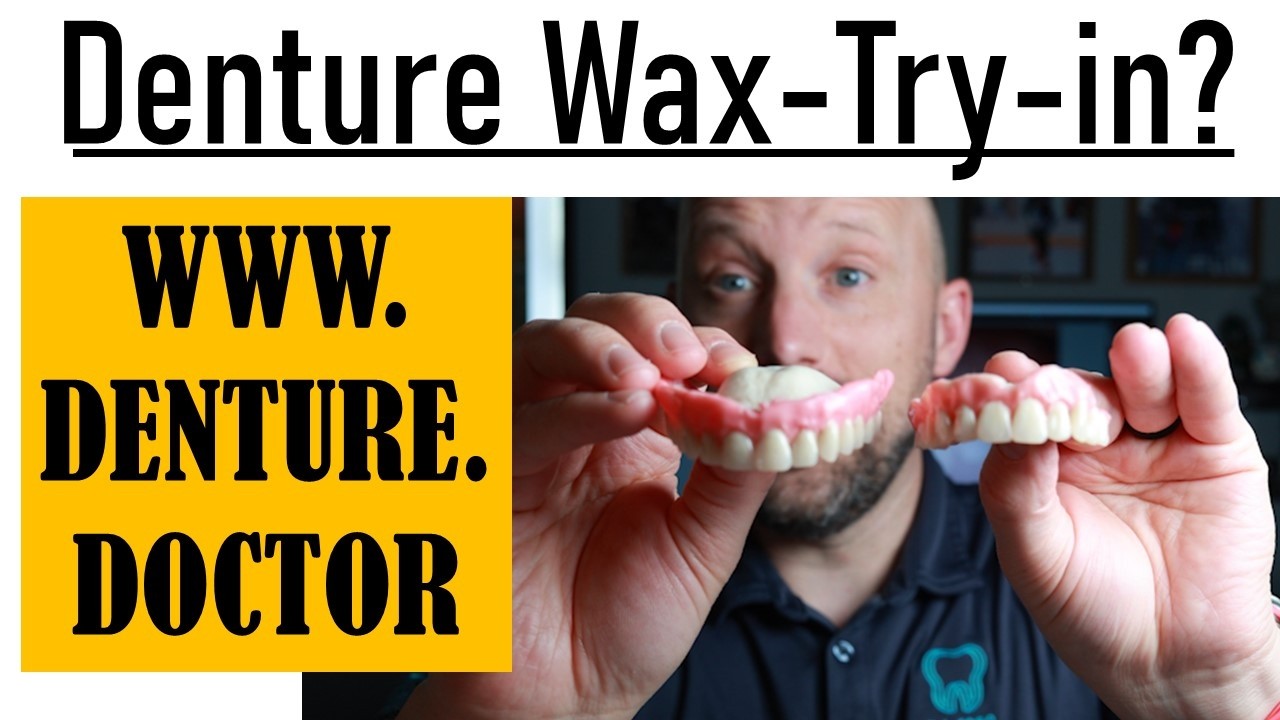 What is a Denture Wax Try-in?