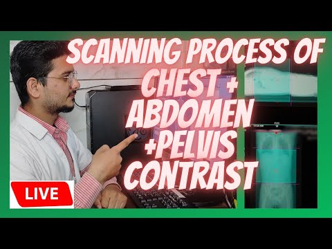 live CT Scan of Chest+ Abdomen and Pelvis Contrast | scanning process of CECT chest+ abdomen pelvis