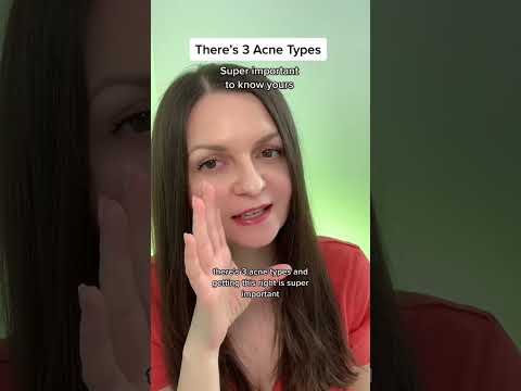 How to clear up acne without antibiotics clearskin #acne #acnefree