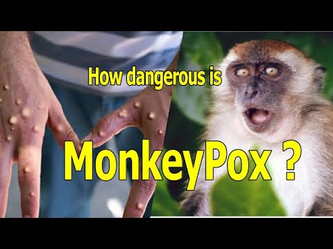 What is monkeypox and how do you catch it? | How do you catch it?