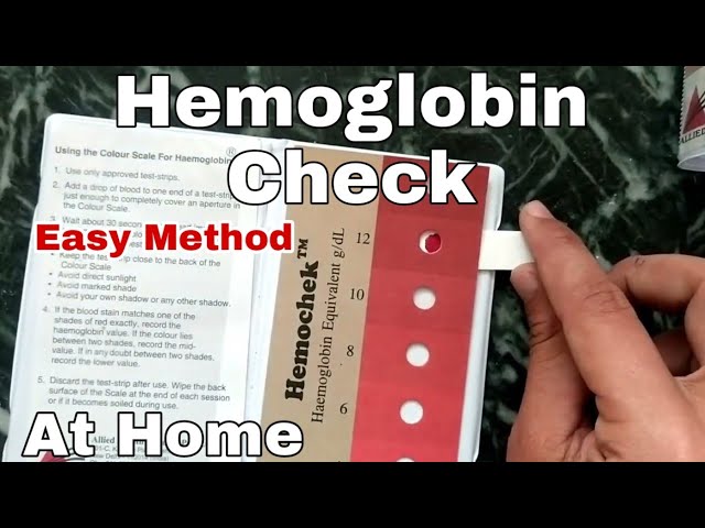 Medical Equipment - Hemocheck Hb Color Scale Starter Kit Wholesaler ...