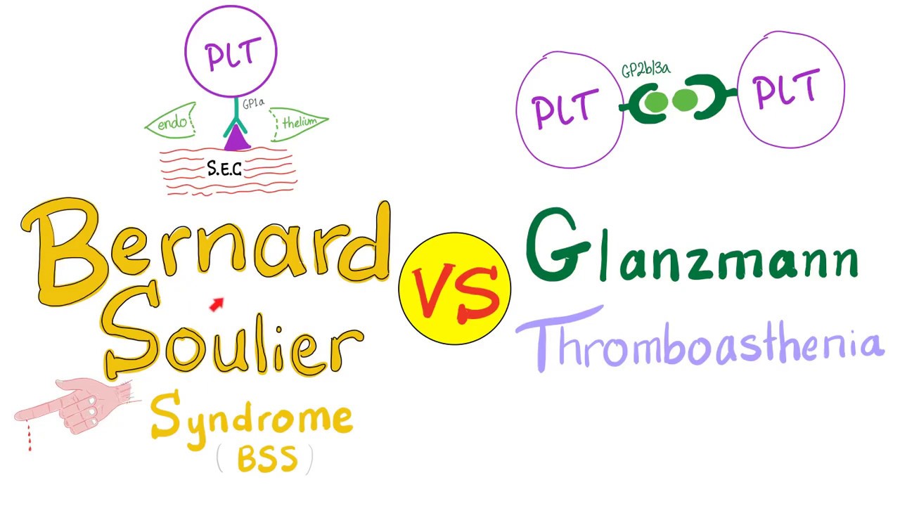 Bernard Soulier Syndrome (BSS) vs Glanzmann Thrombasthenia (GT)