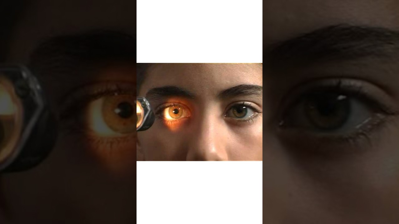 Photomotor reflex | Neuroanatomy