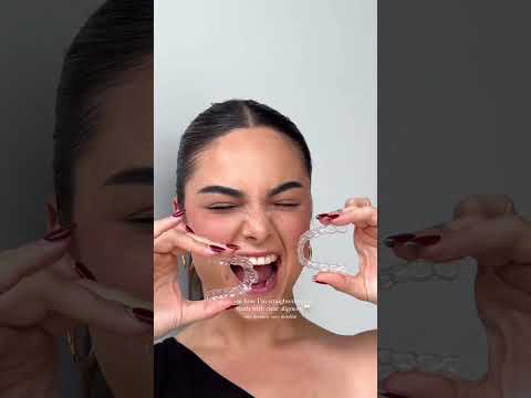 Clear aligners are the DEFINITION of very mindful, very cutesy, and very demure with bitesoft ✨