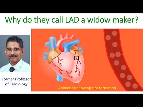 Why do they call LAD a widow maker?