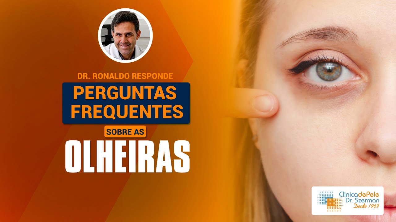 Perguntas frequentes sobre as olheiras [Olheiras]