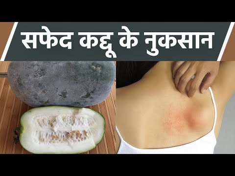 सफेद पेठा खाने के गंभीर नुकसान । सफेद पेठा खाने से क्या होता है ।  Boldsky