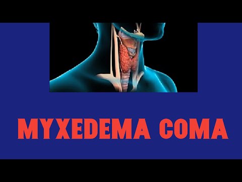 Myxedema coma || Hypothyroidism