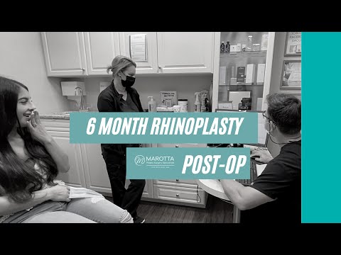 6 Month Rhinoplasty Post Op at Marotta Plastic Surgery Specialists