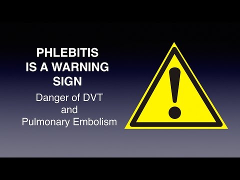 How To Get Rid of Phlebitis - Superficial Vein Thrombosis