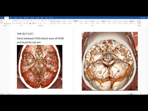How to make COW reconstructions of CTA head exams using TeraRecon video 1 of 3
