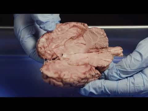 Carolina's Perfect Solution Sheep Brains Product Feature Video