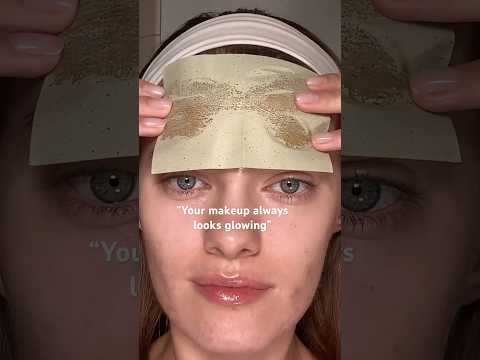 Oily skin benefits✨💖 but at this point is Acne worth it?🥹🥲 #acne #skincareroutine #acnetreatment