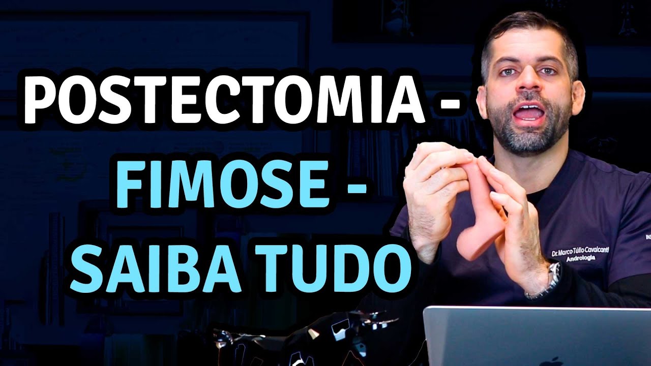 Postectomy - Phimosis - Learn Everything | Dr. Marco Túlio Cavalcanti - Andrologist and Urologist