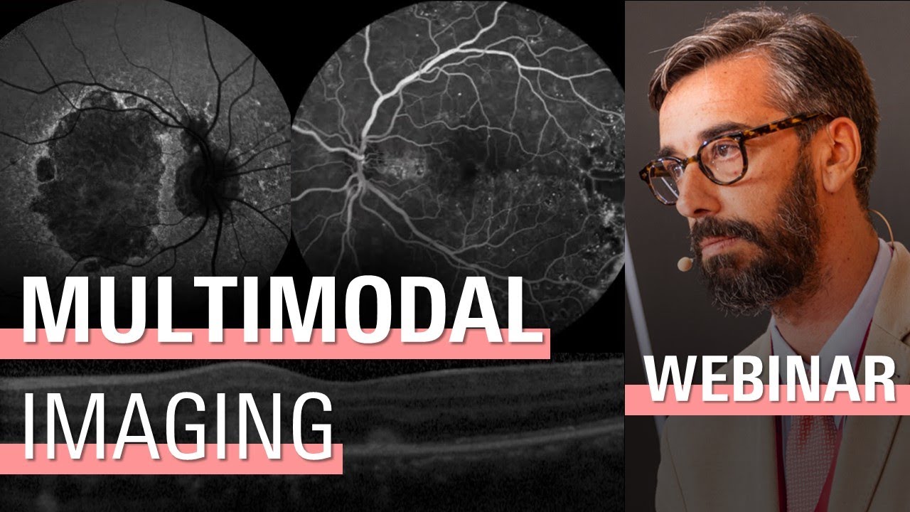 Clinical Application of Multimodal Imaging
