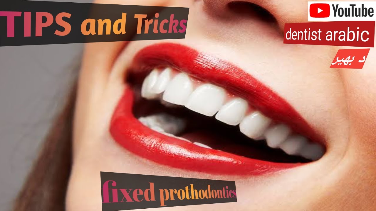 diagnosis fixed prothodontics(tips and tricks)medical history and dental history