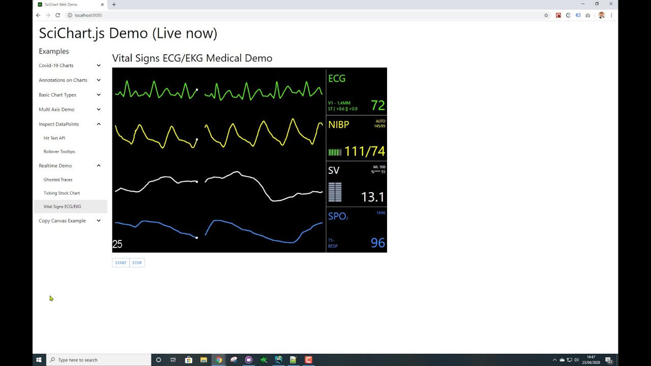 SciChart.js Preview: Real-Time WebGL & WebAssembly Charts for Big Data
