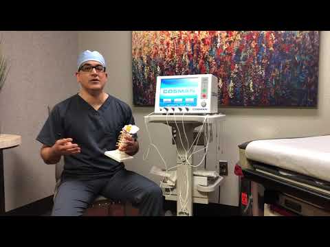 Cervical Radiofrequency Rhizotomy (Neurotomy)