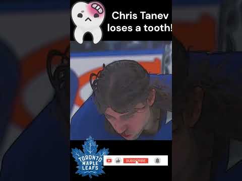 Ouch! that has got to hurt! Chris Tanev spits out tooth! #nhl #hockey #Leafs #dentist