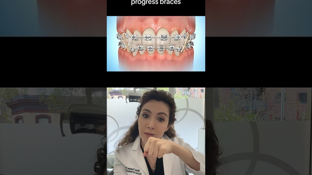 How Can Orthodontic Elastics Help With Your Braces?!