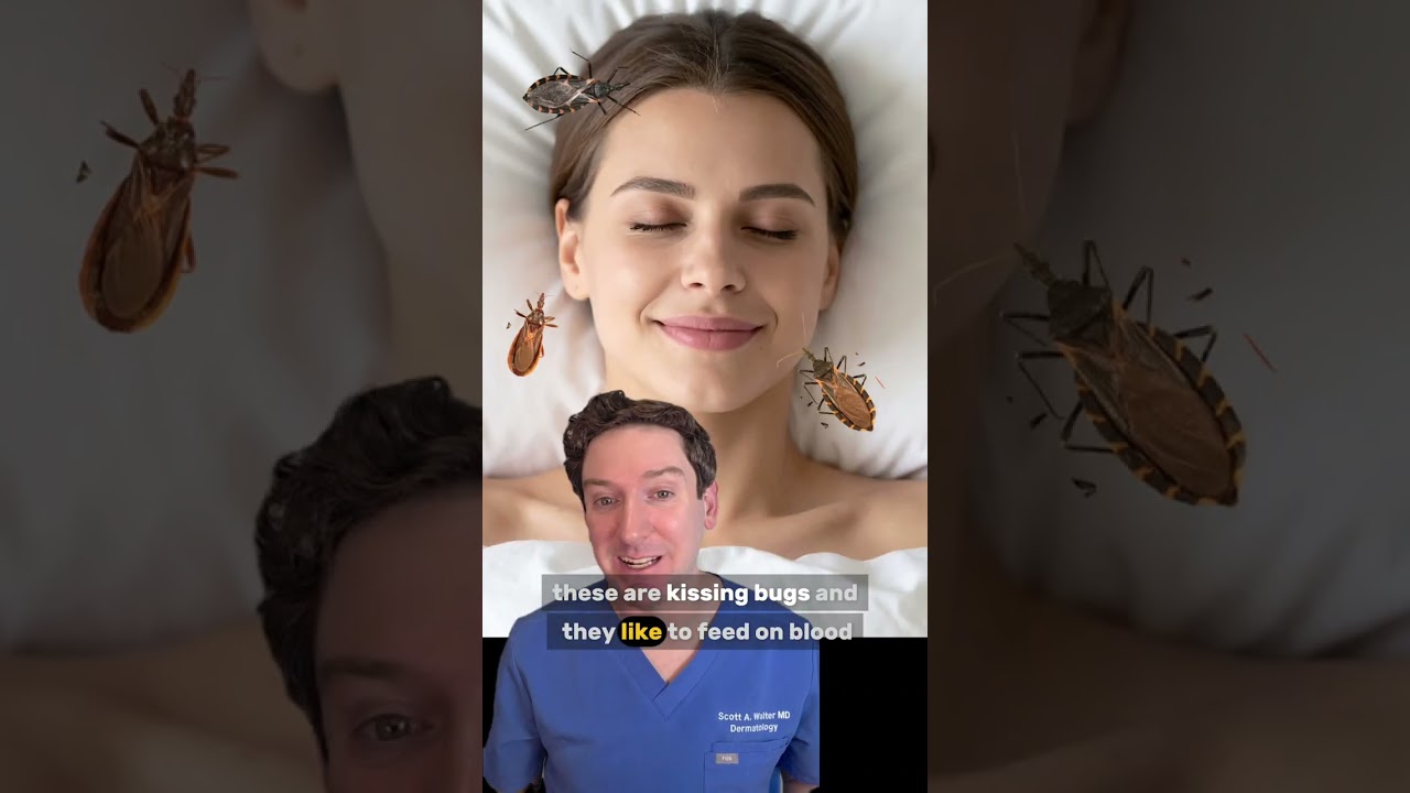 🚨 Meet the kissing bug: This insect doesn't just bite you while you sleep... #kissingbug #parasite