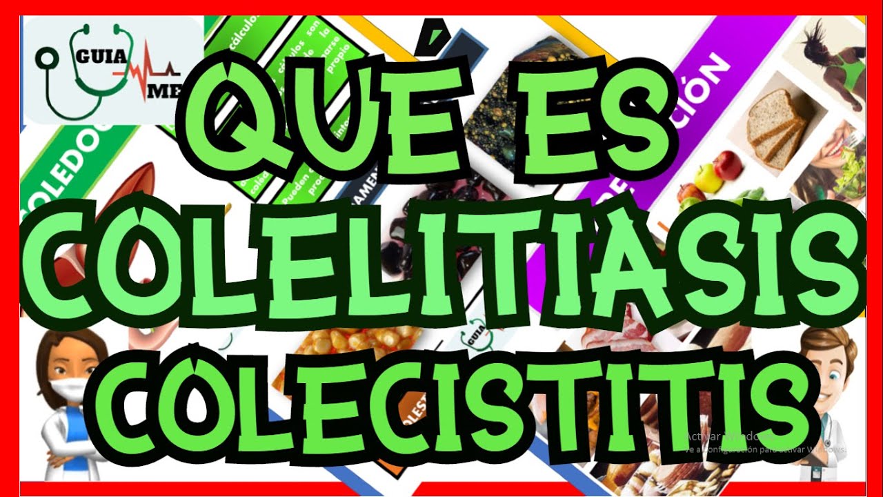 WHAT IS CHOLELITHIASIS AND CHOLECYSTITIS | GuiaMed