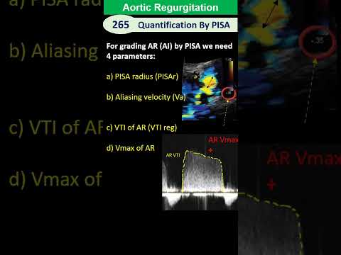 Aortic Regurgitation grading by PISA