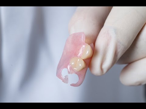 Single Tooth Denture | One tooth denture solution