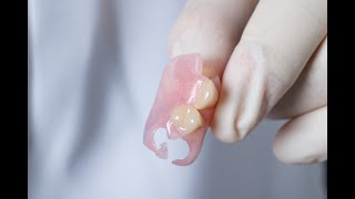 Single Tooth Denture | One tooth denture solution