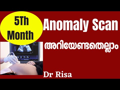 Anomaly Scan in Pregnancy malayalam | 5 Month scanning During Pregnancy | Second Trimester Scan