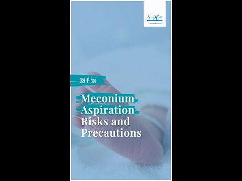 Meconium Aspiration Risks And Precautions