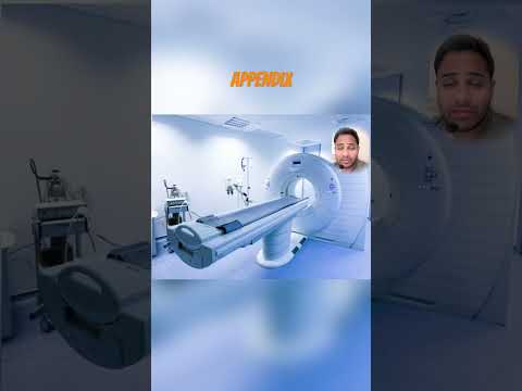 Let’s talk appendix #appendicitis