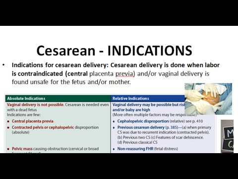 Obstetrics 691 c Cesarean section CS Indication relative absolute