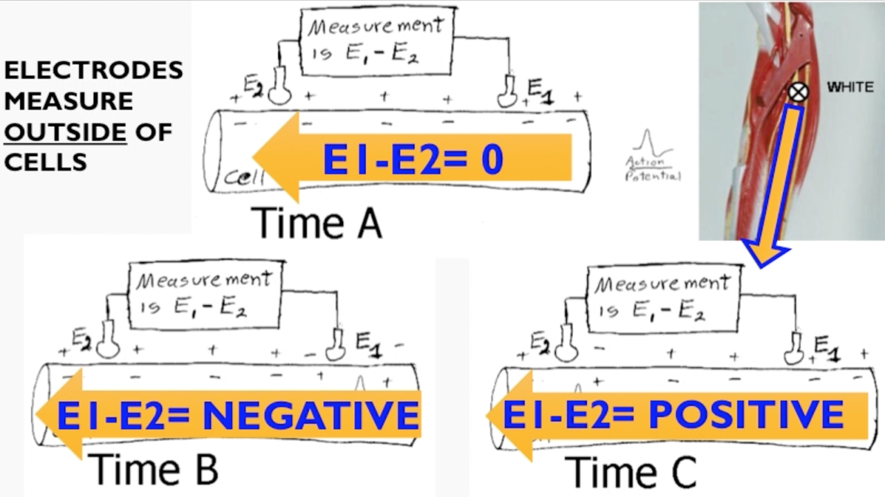 Electromyography (EMG) Biopac lecture