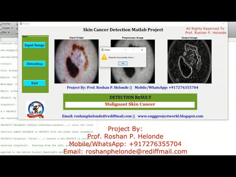 Skin Cancer Detection Matlab Code | Skin Cancer Detection Using Image ...