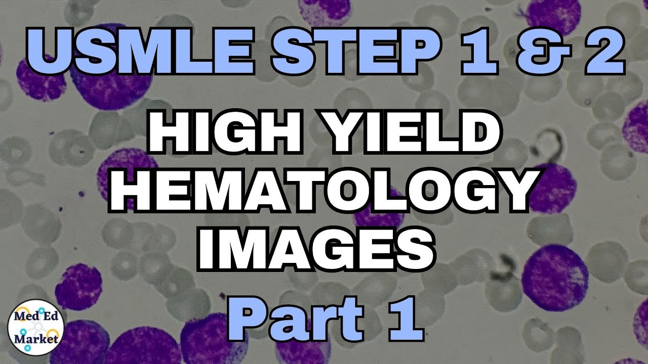 High Yield Hematology Images | USMLE/Step 1/Step 2/COMLEX (part 1)