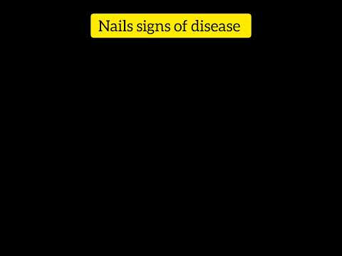 #Nails signs of disease#shorts