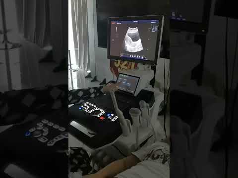 Ultrasound Machine