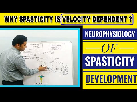 NEUROPHYSIOLOGY OF SPASTICITY DEVELOPMENT (MECHANISM OF HYPERACTIVE STRETCH REFLEX)