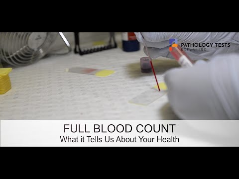 Full blood count - what it tells your doctor about your health