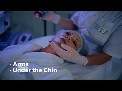 Lipo Laser – Slender Lasers