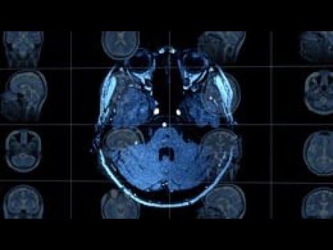 Northwestern Radiation Oncology Residency Program