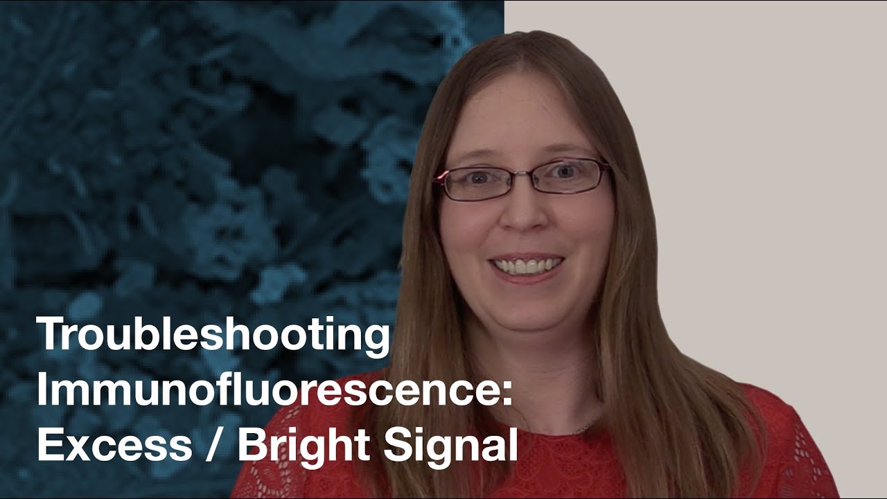Troubleshooting Immunofluorescence: Excess (Bright) Signal  | CST Tech Tips