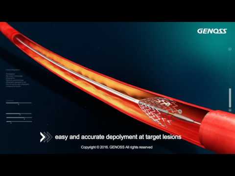 Coronary Stents - Heart Artery Stents Latest Price, Manufacturers ...