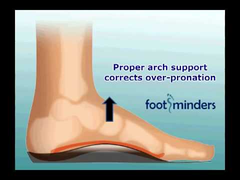 Different Types of Orthotics and How to Choose The Right Ones For You ...