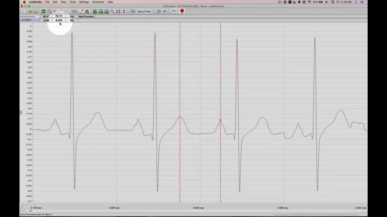 LabScribe Data Acquisition Software - iWorx Systems, Inc.