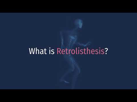 What is Retrolisthesis? Retrolisthesis Definition