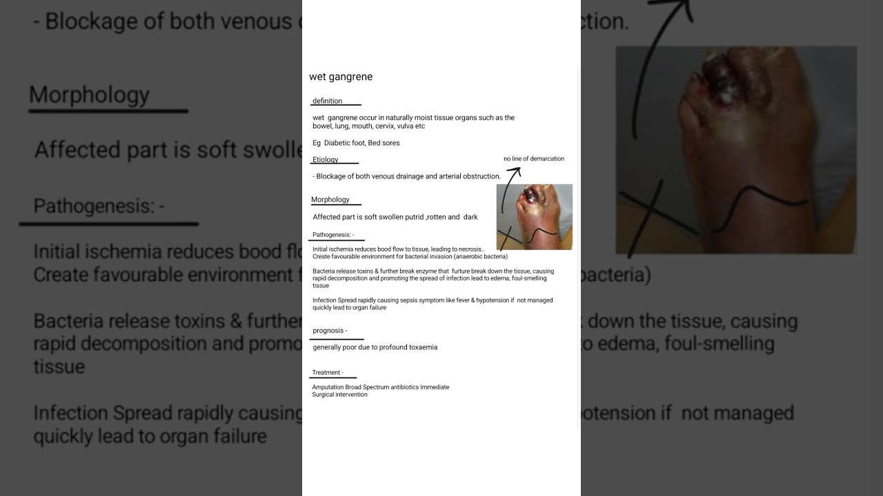Wet Gangrene in 5 Minutes | Pathology Simplified # viral notes
